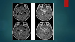 CNS IMAGING.pptx hbcvgvscbsvfxdsgvhjdvbjhfv | PPT