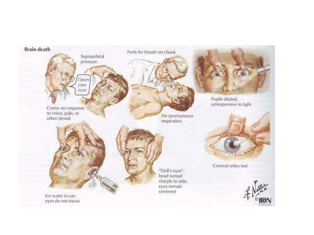 neurosurgery.Cns infection.(dr.ali o. sadoon) | PPT