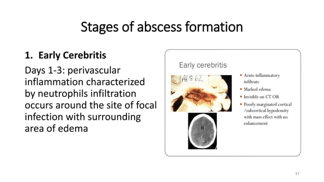 CNS INFECTION - Copy.pptx