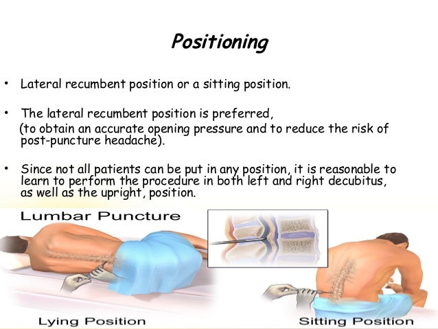 Lumbar Puncture Position What Is A Lumbar Puncture? Dana Farber