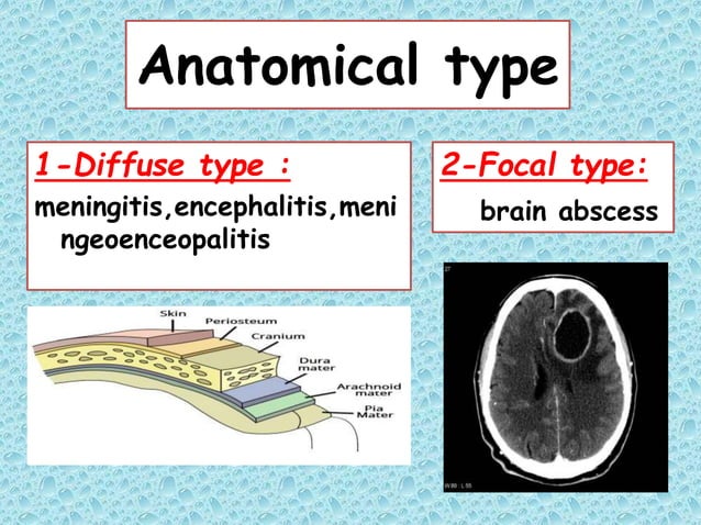 Cns infection 2019 | PPT