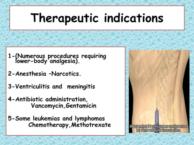 Cns infection 2019 | PPT