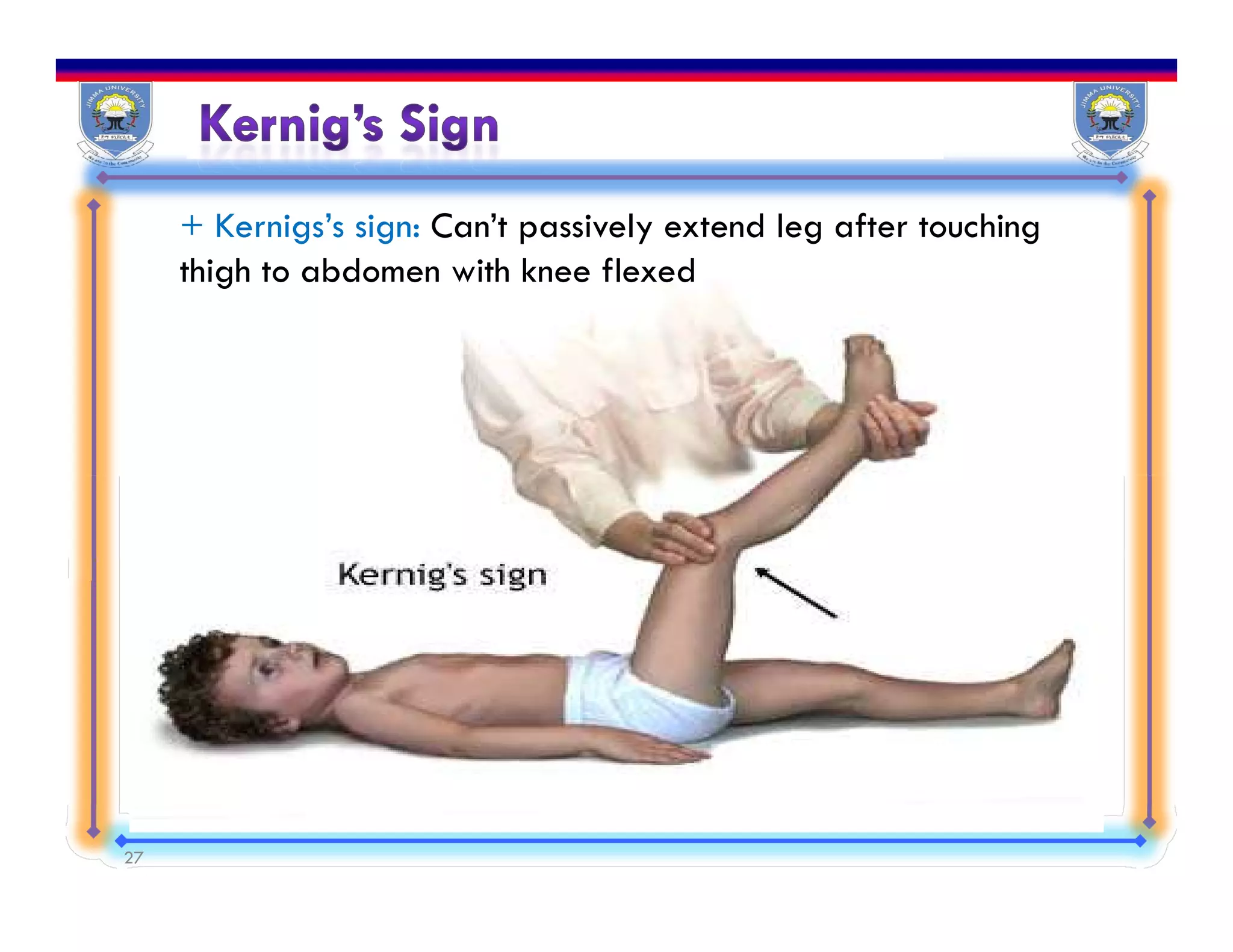 Pharmacotherapy of Central Nervous system infections | PDF