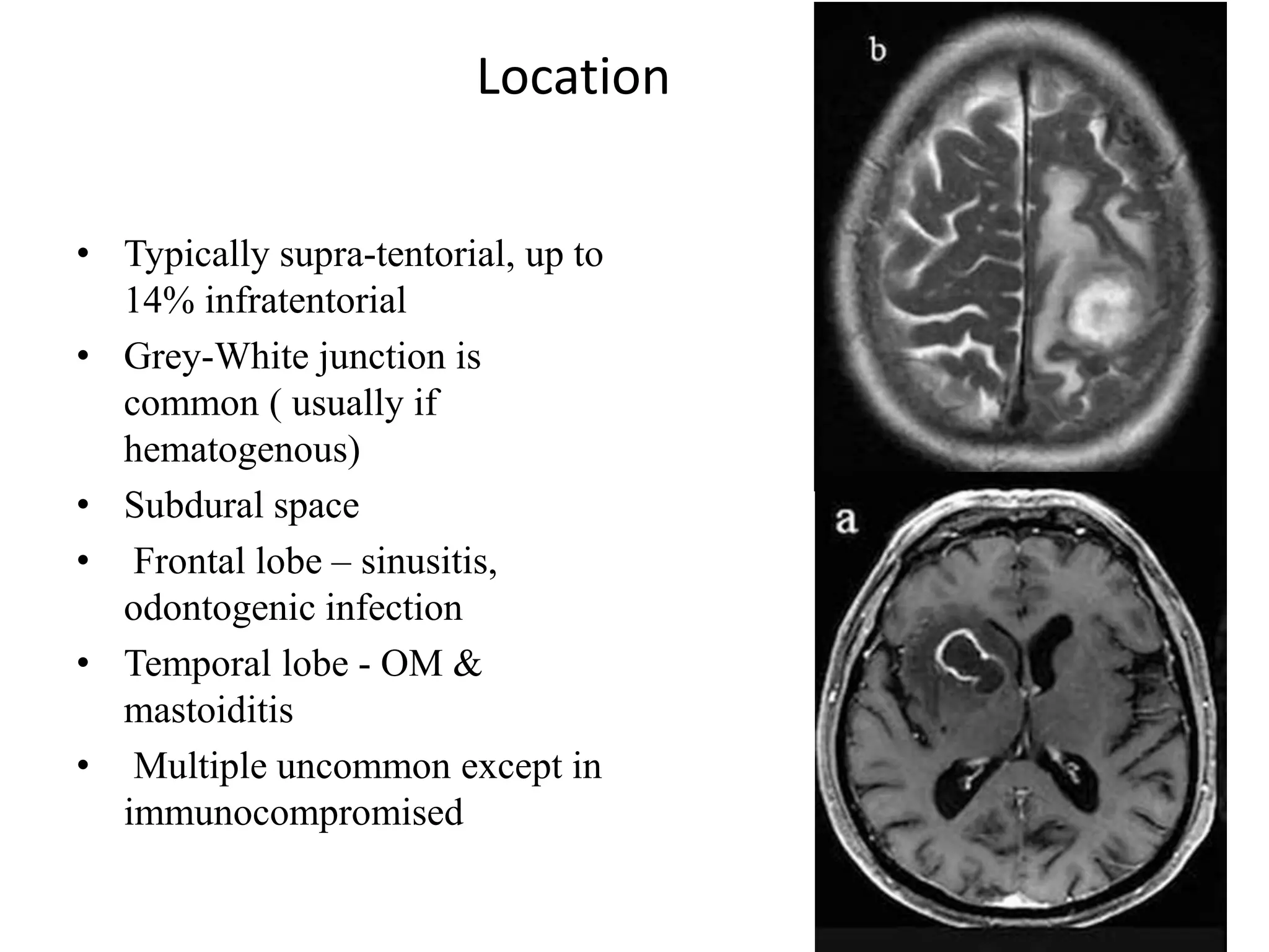 Imaging in CNS Infections | PPTX
