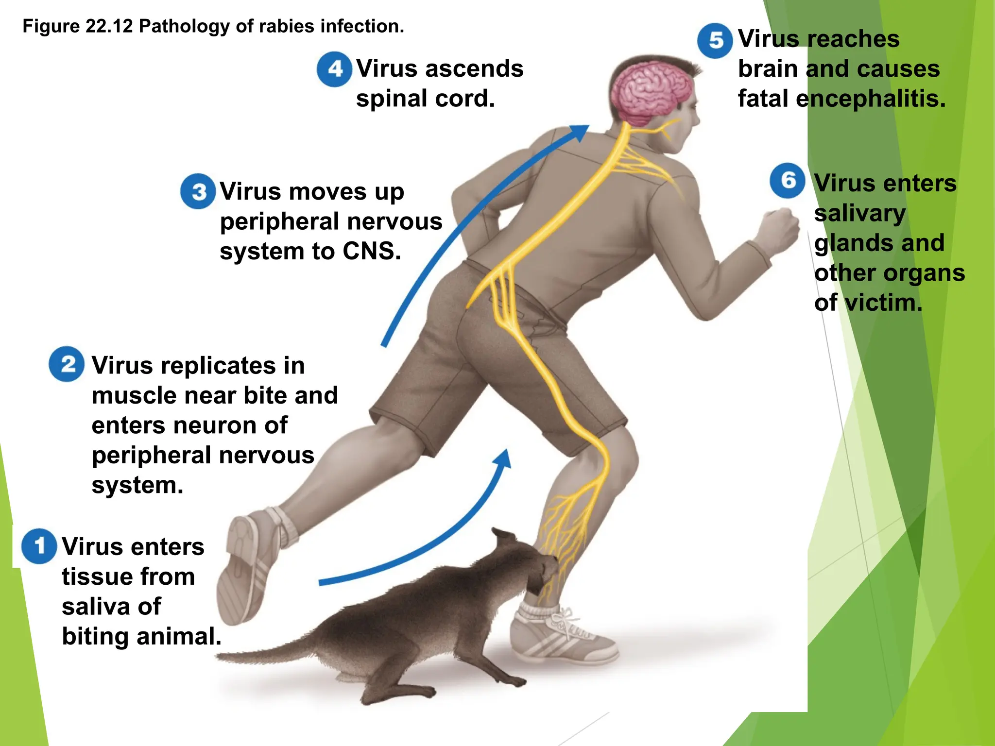 CNS infections.ppt kjhgfdsertyuiolkjhgfxcvbn | PPT