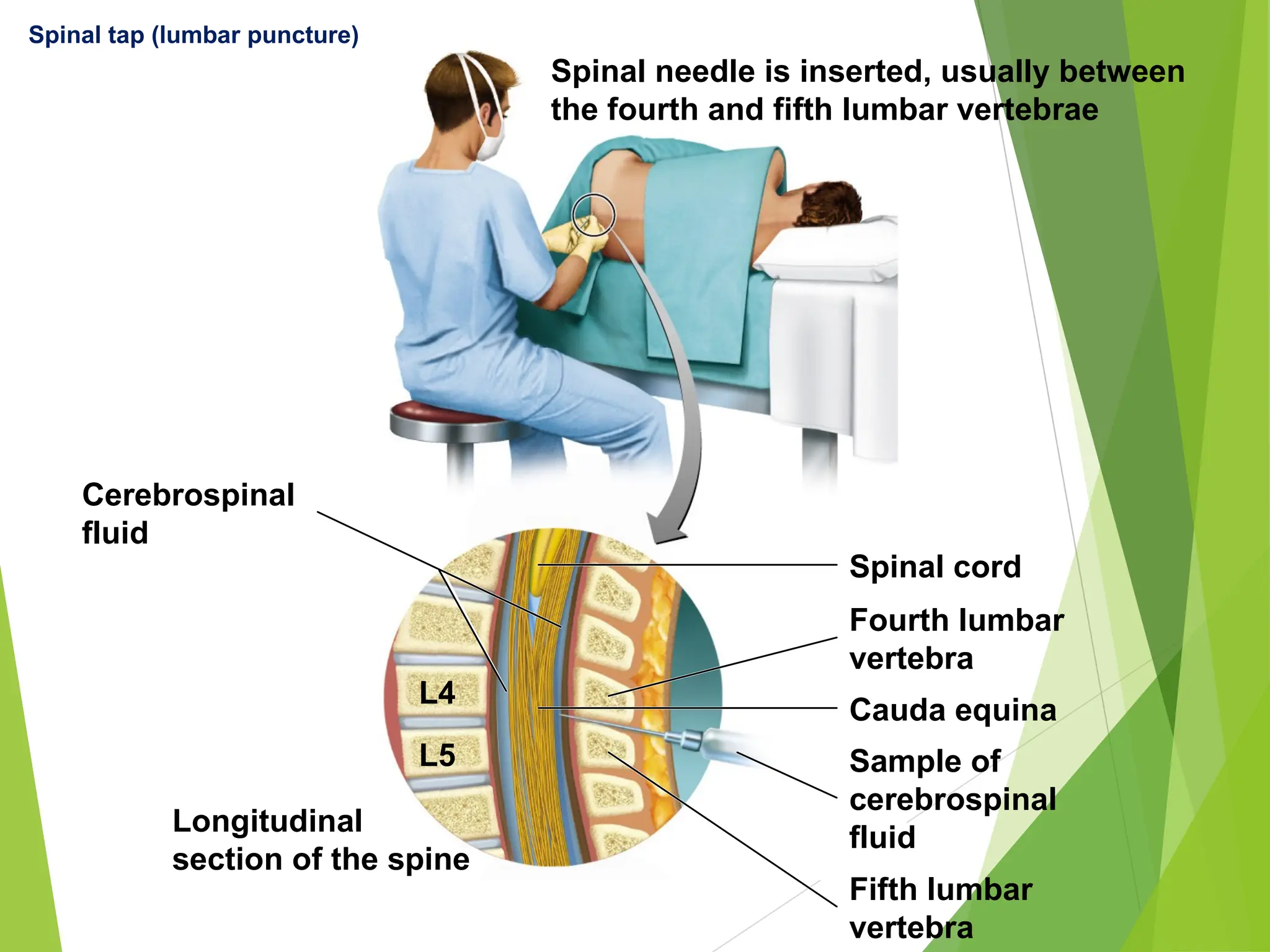 CNS infections.ppt kjhgfdsertyuiolkjhgfxcvbn | PPT