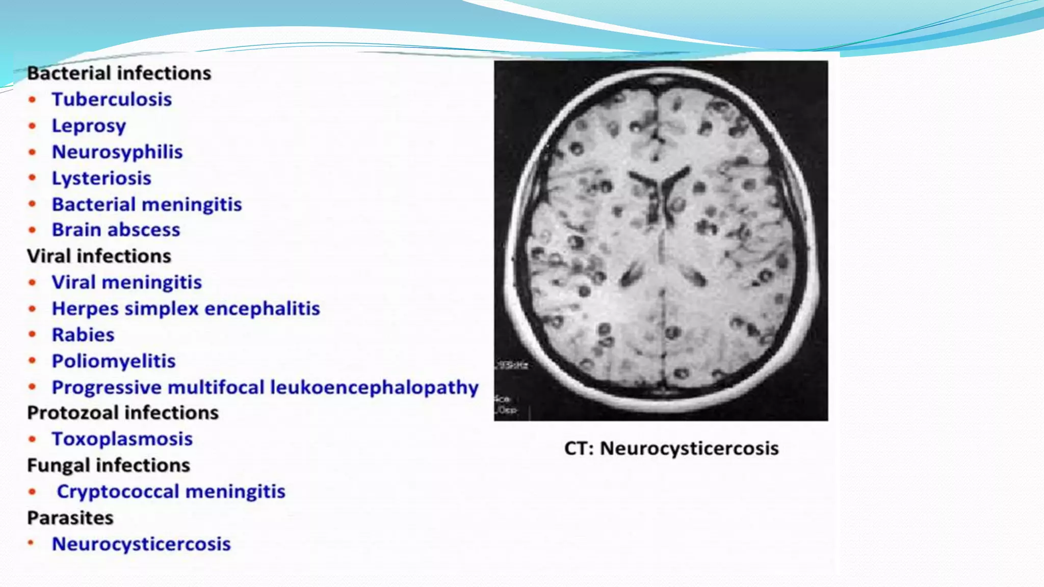 Cns infections biplave nams | PPT