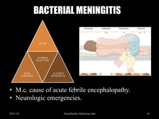 Cns Infections congenital, pyogenic & viral - Imaging | PPTX