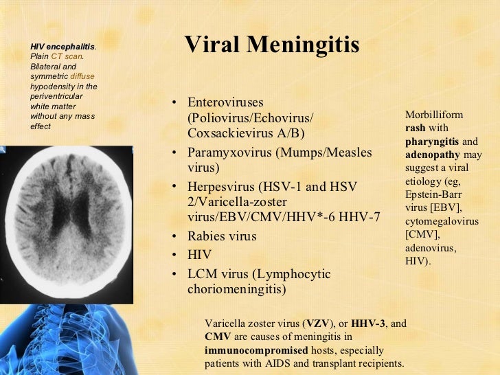 CNS Infections Siddiqui