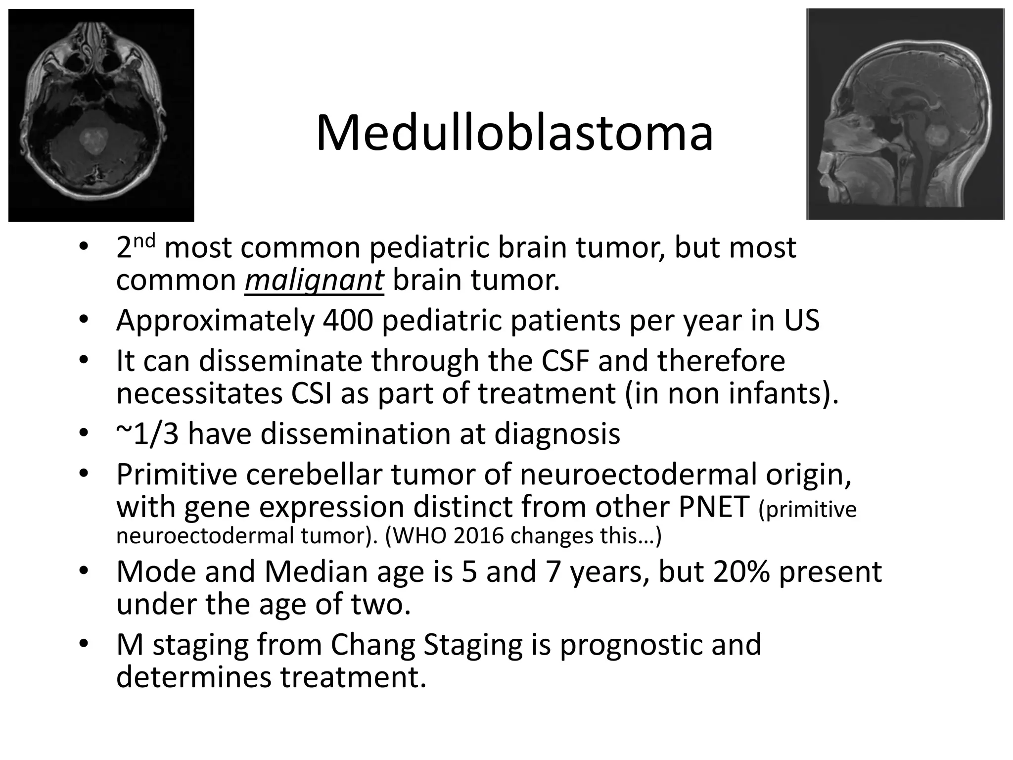 CNS Medulloblastoma radiotherapy | PDF
