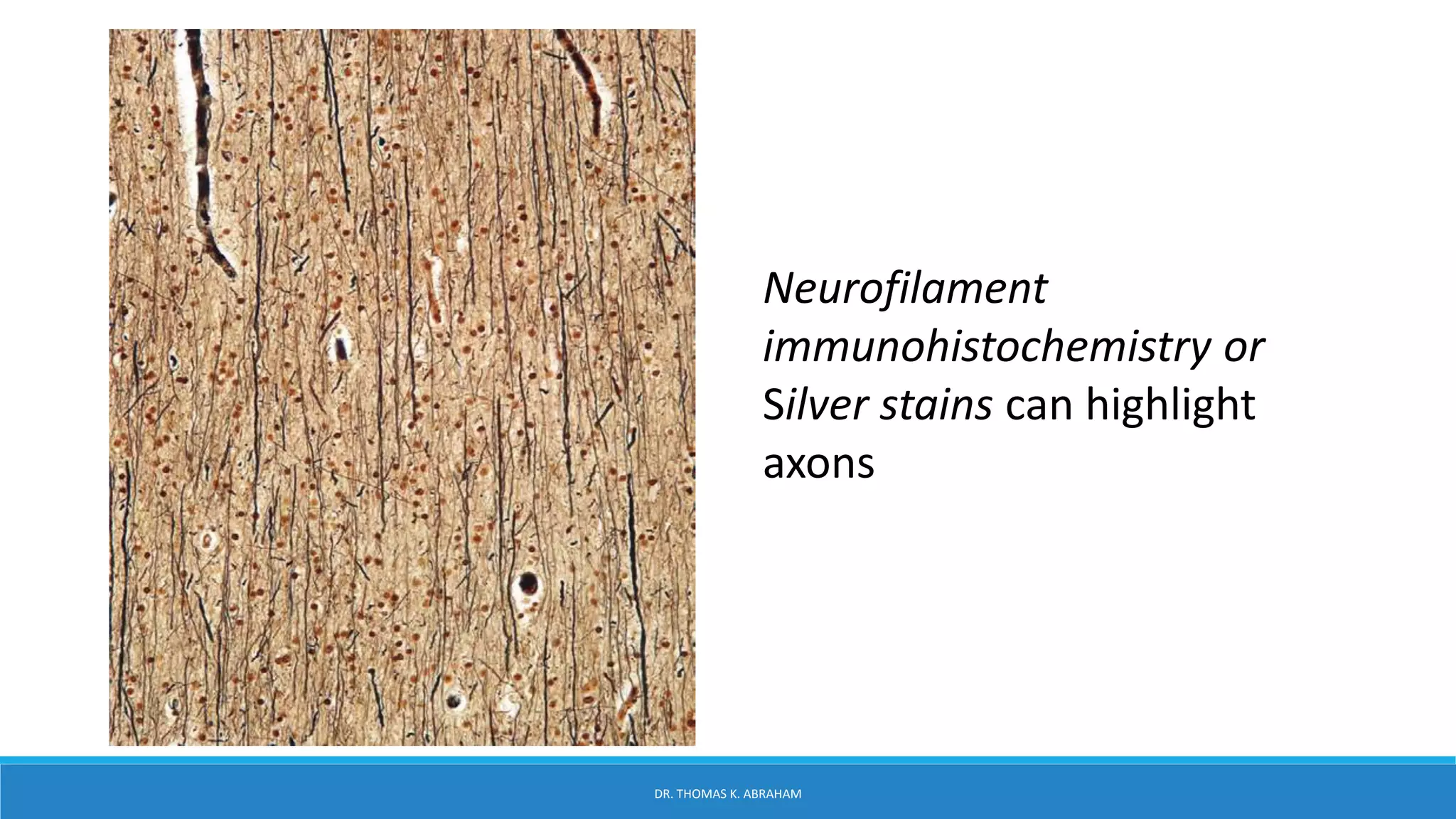 CNS normal histology | PPTX