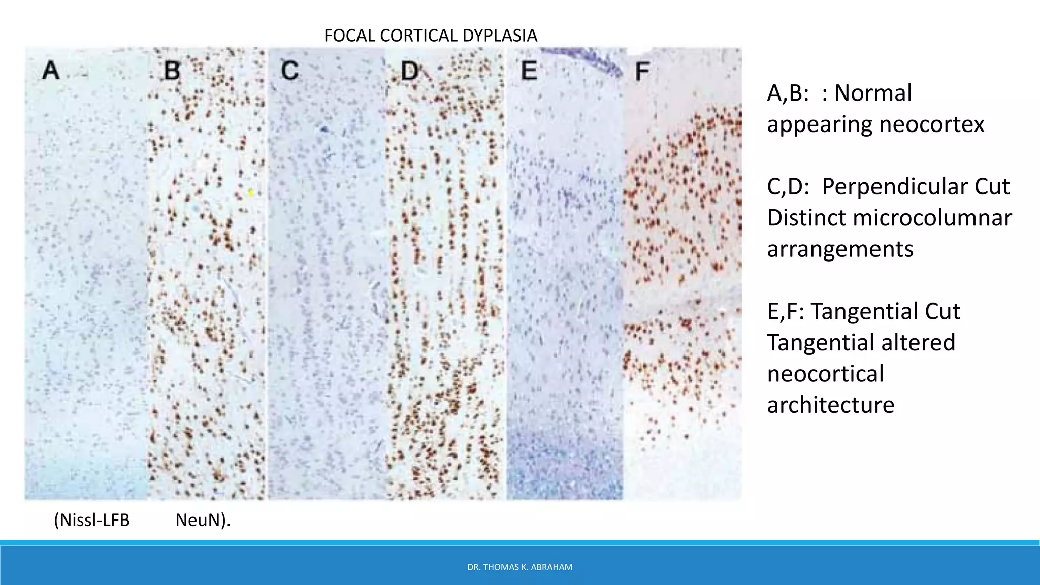 CNS normal histology | PPTX
