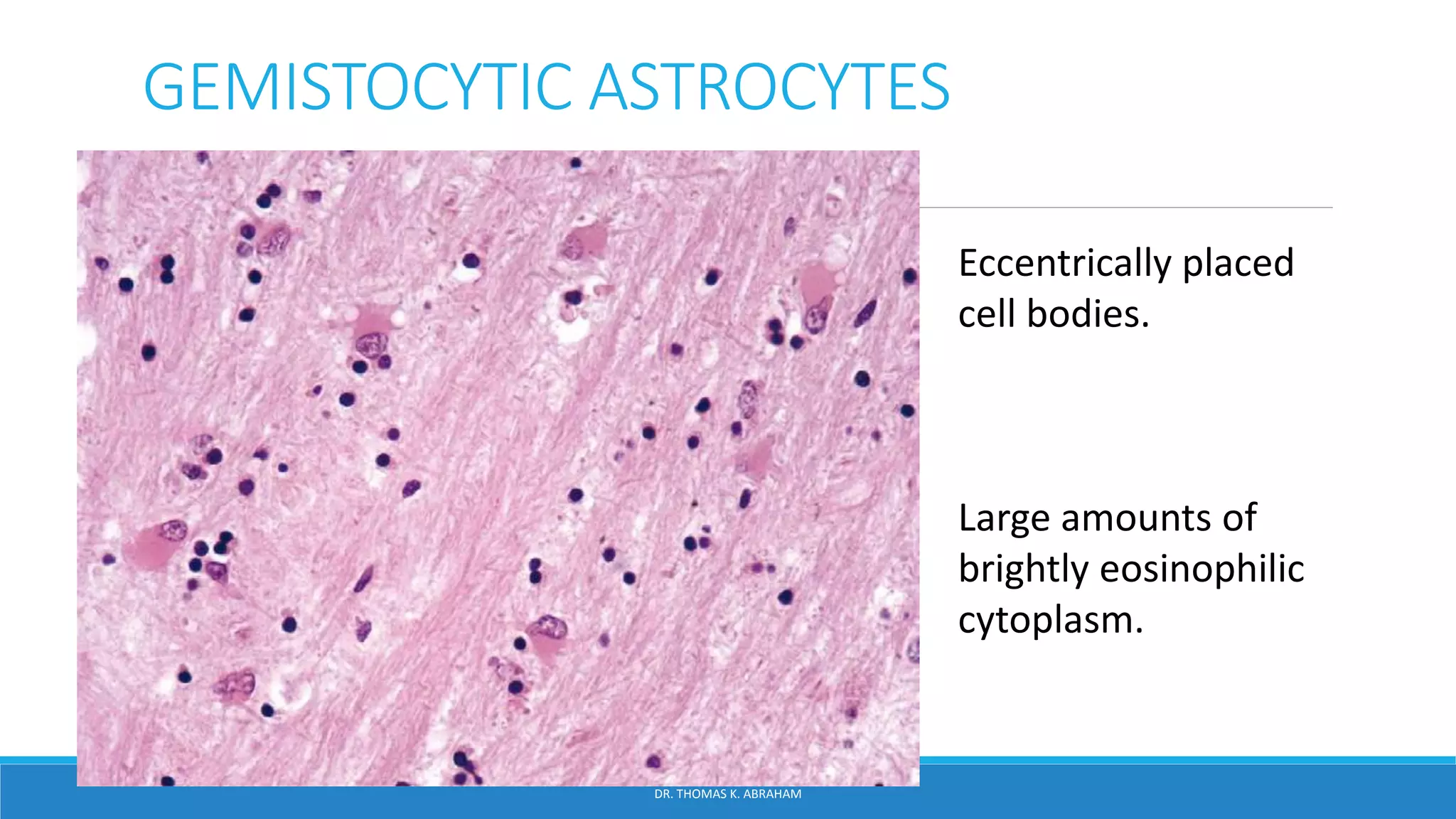 CNS normal histology | PPTX