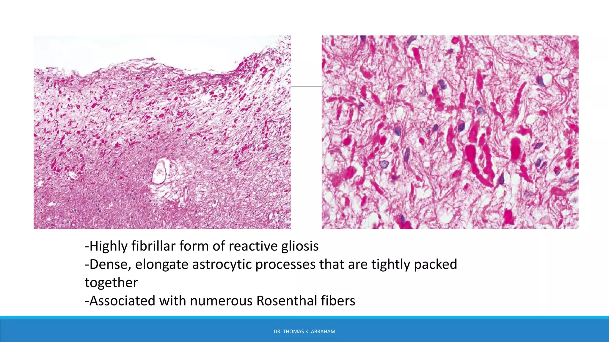 CNS normal histology | PPTX