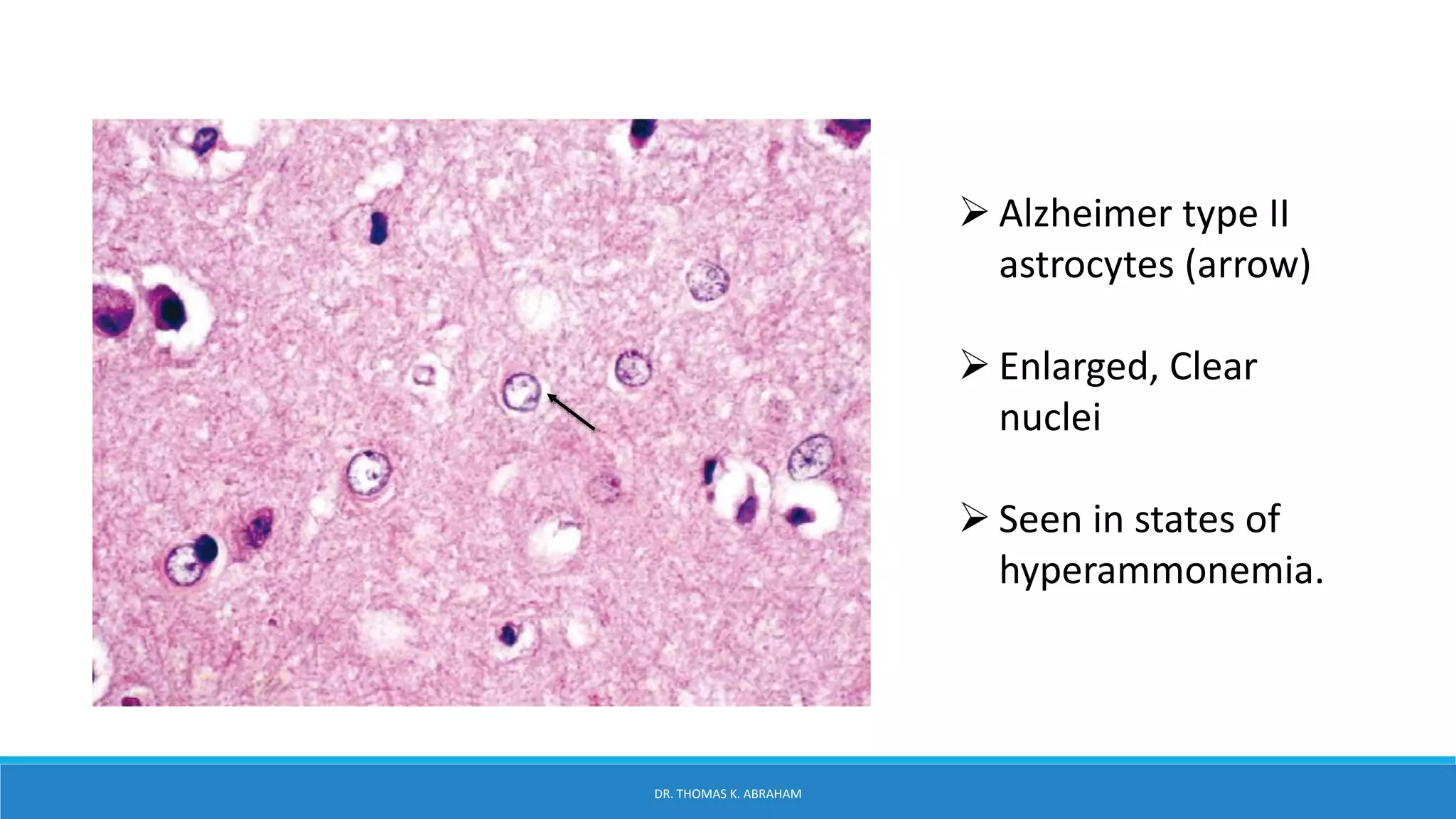 CNS normal histology | PPTX