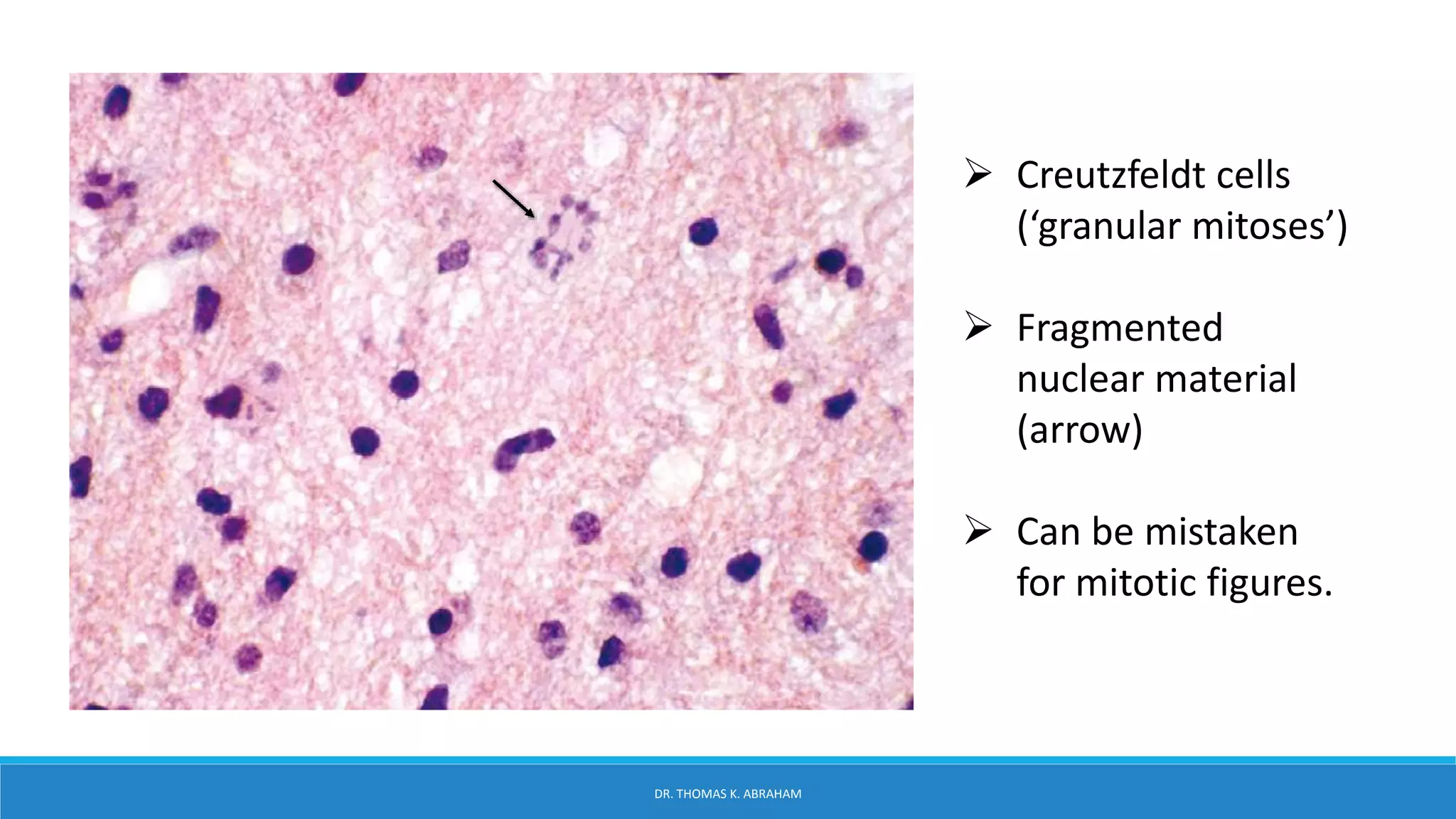 CNS normal histology | PPTX