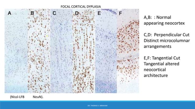 CNS normal histology | PPTX