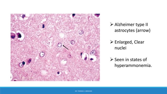 CNS normal histology | PPTX