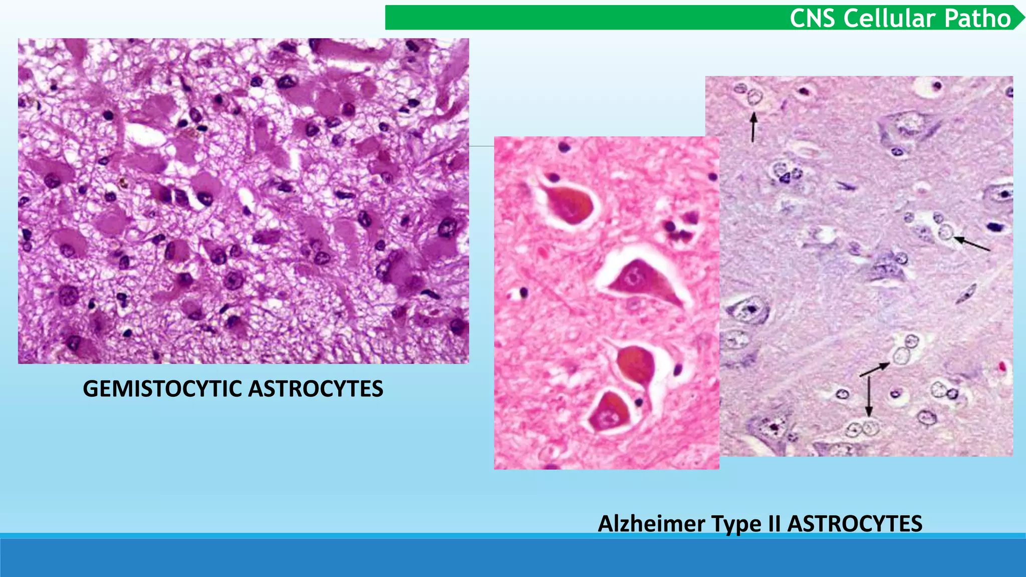 Central nervous system pathology | PPTX