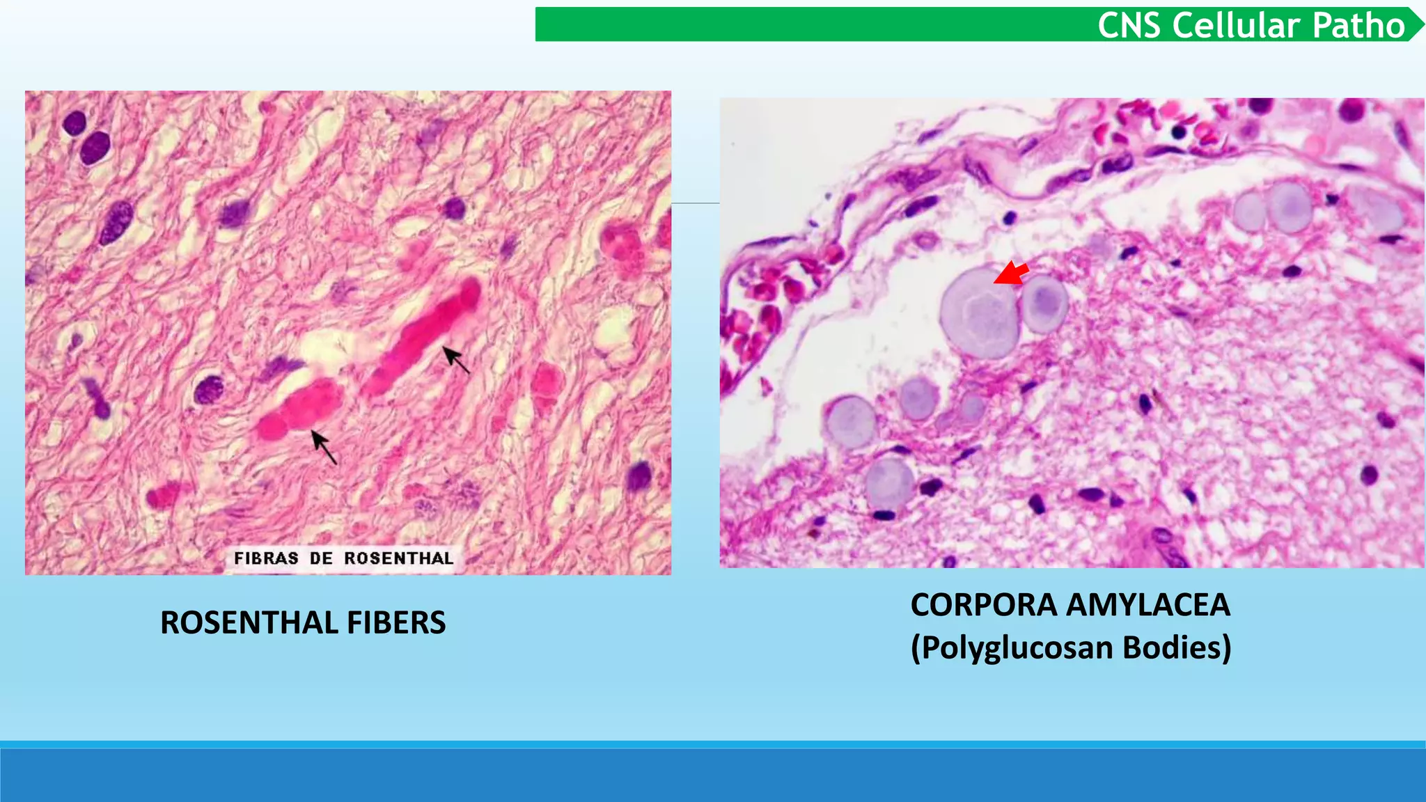 Central nervous system pathology | PPTX