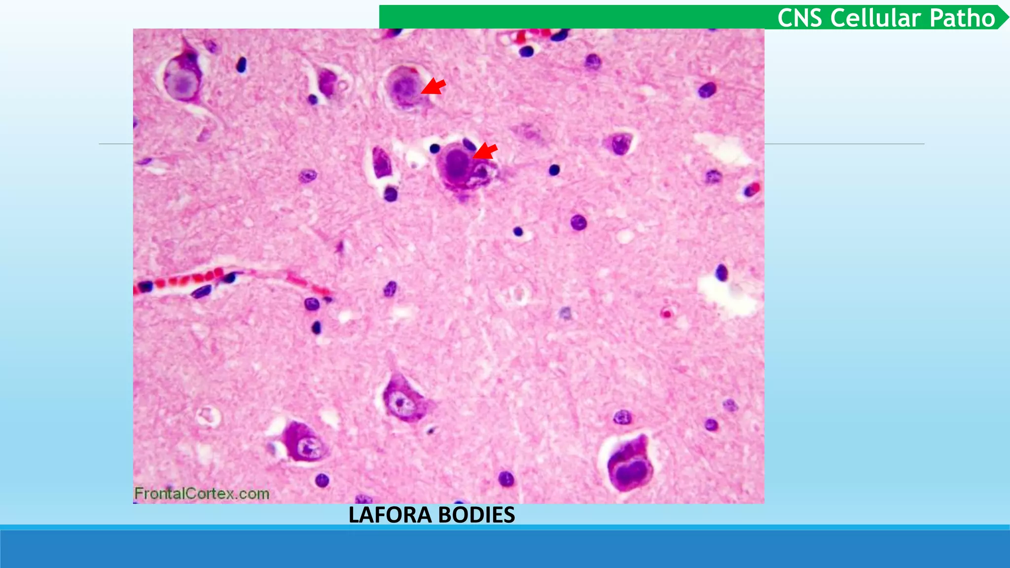 Central nervous system pathology | PPTX