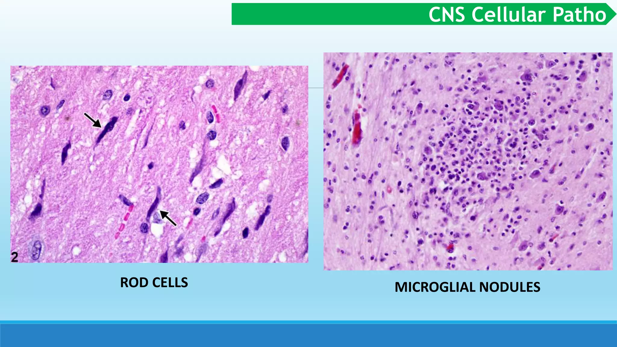 Central nervous system pathology | PPTX