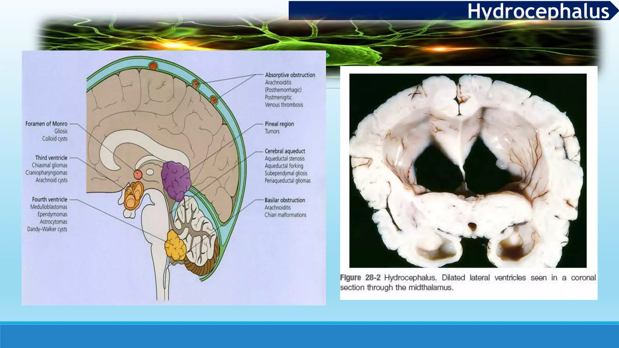 Central nervous system pathology | PPTX
