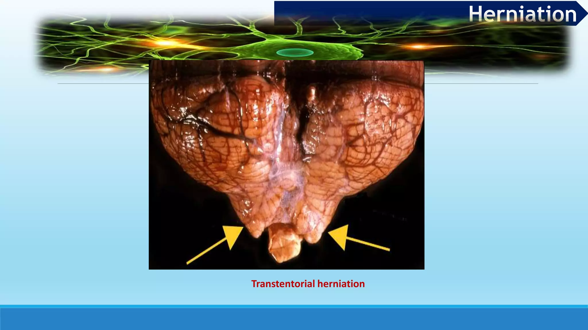 Central nervous system pathology | PPTX