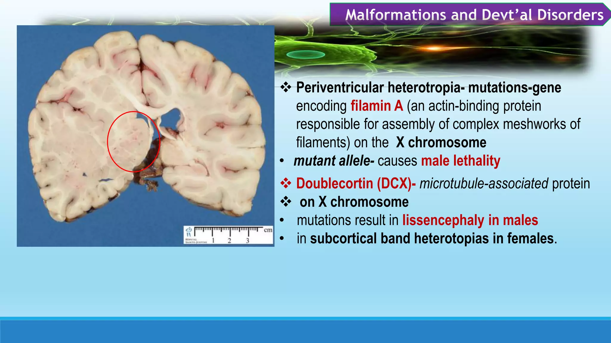 Central nervous system pathology | PPTX