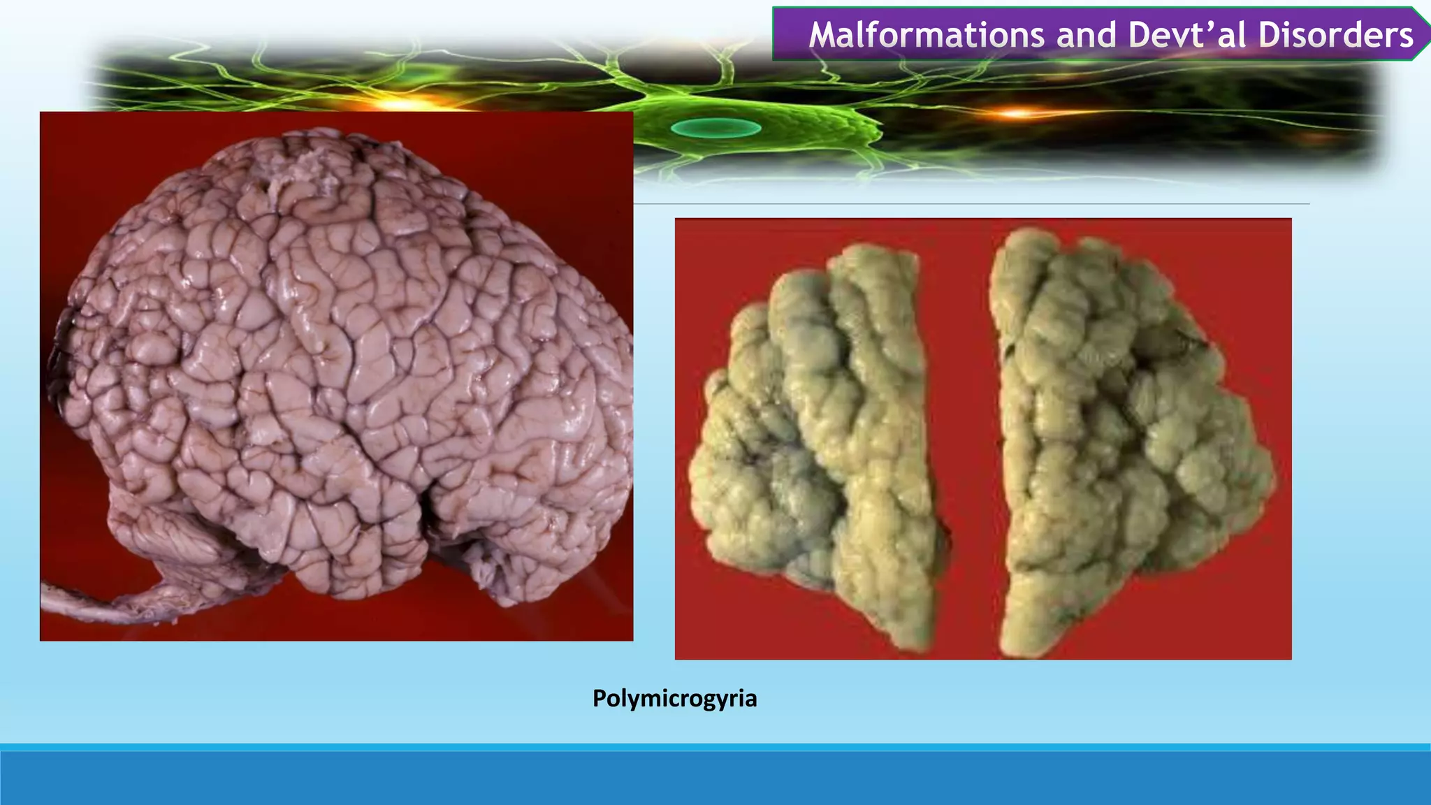 Central nervous system pathology | PPTX