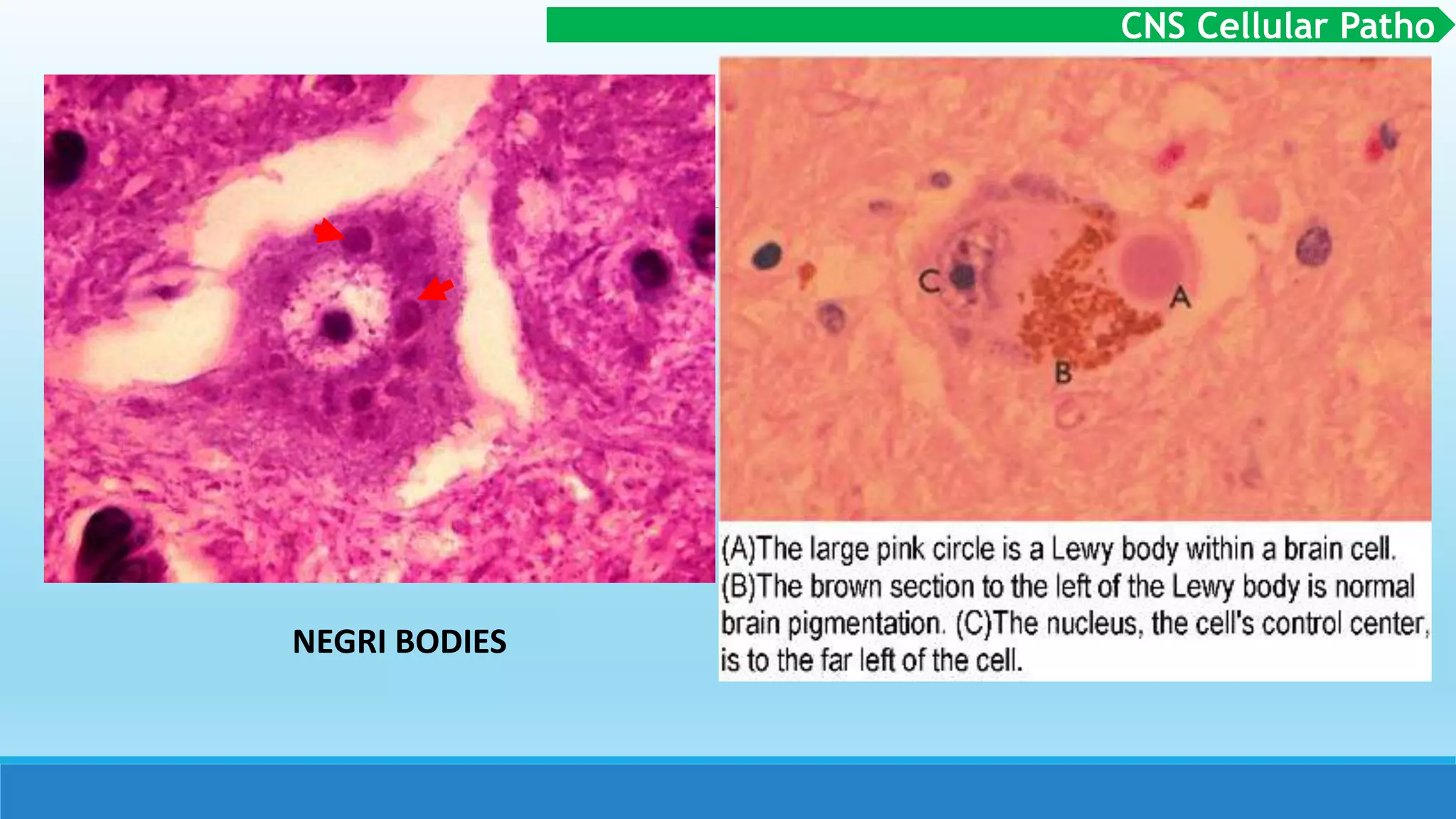 Central nervous system pathology | PPTX