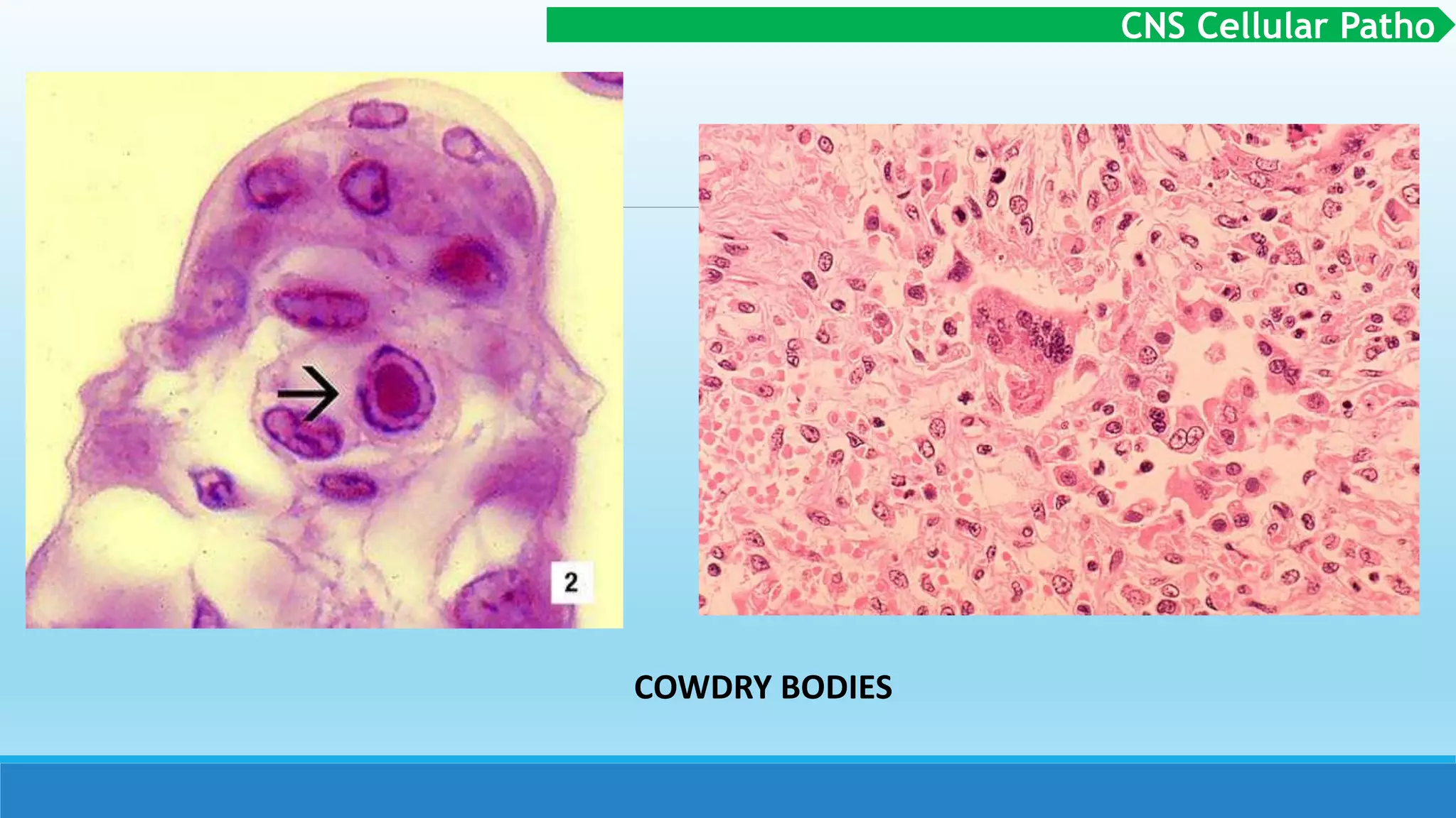 Central nervous system pathology | PPTX