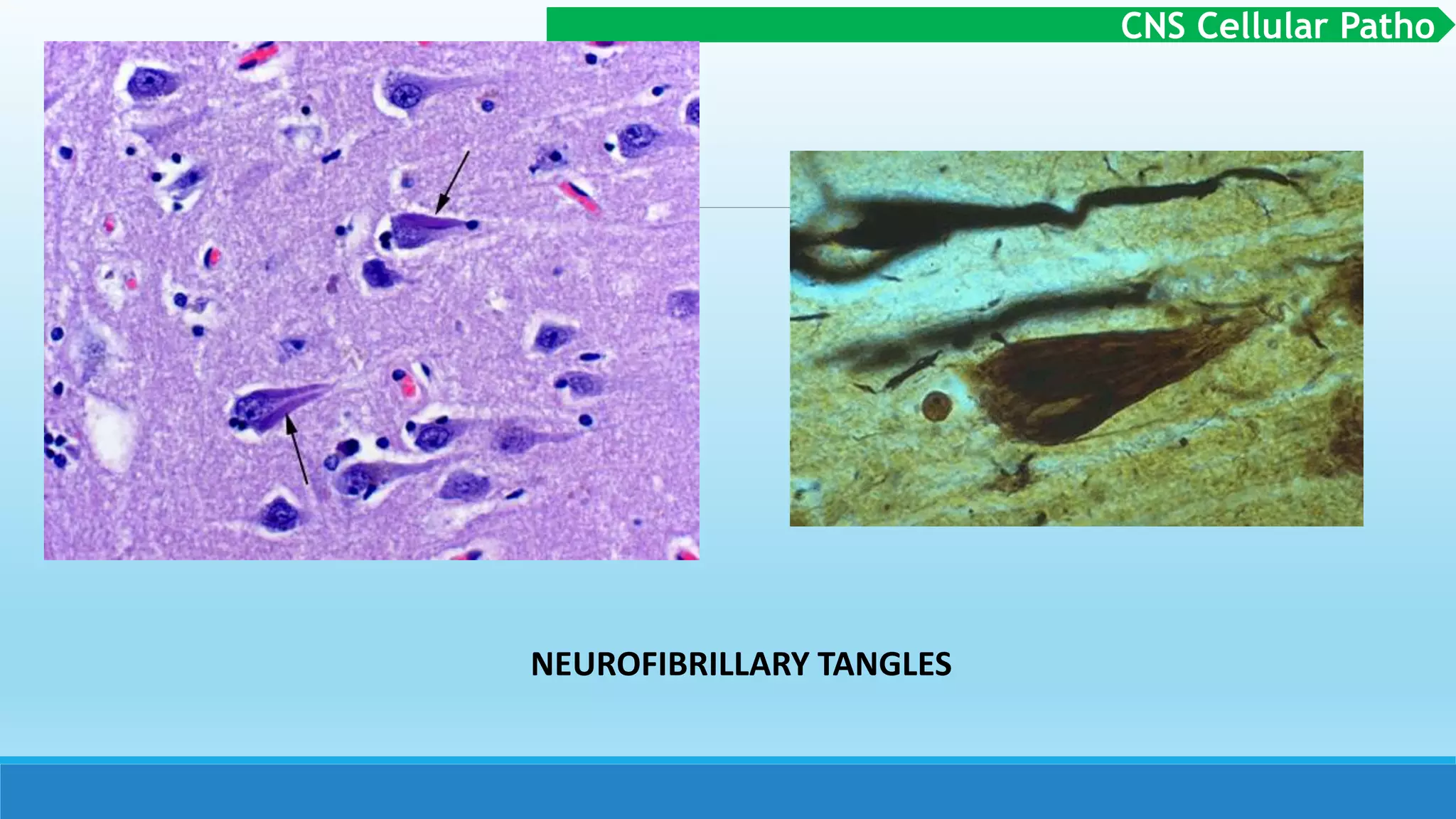 Central nervous system pathology | PPTX
