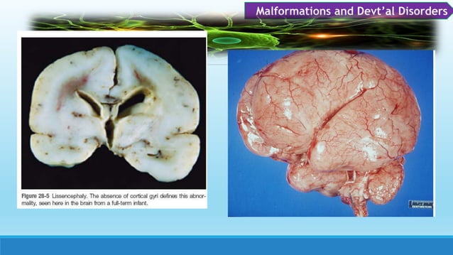Central nervous system pathology | PPTX