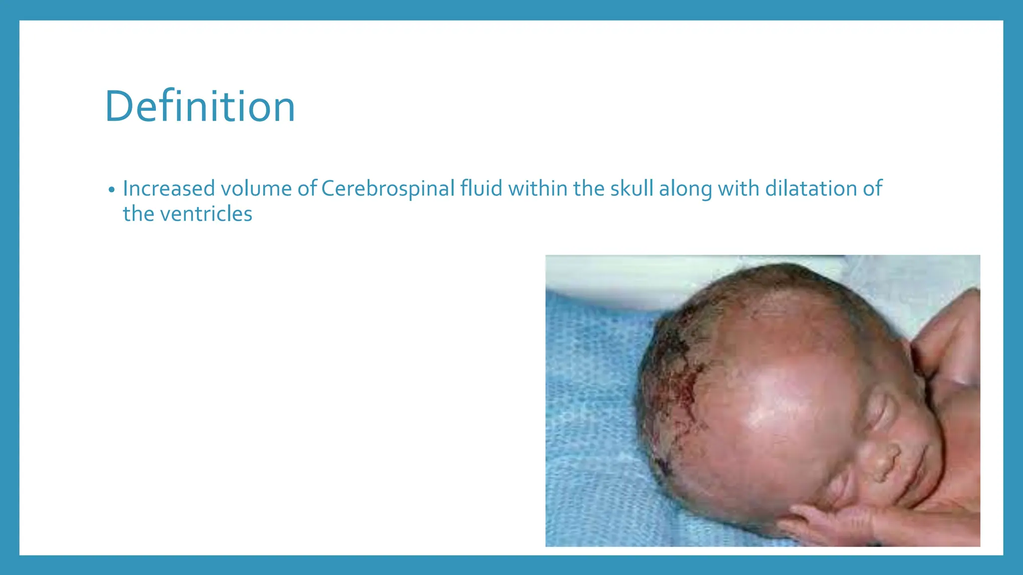 Hydrocephalus, meningitis and encephalitis - Pathology | PPTX