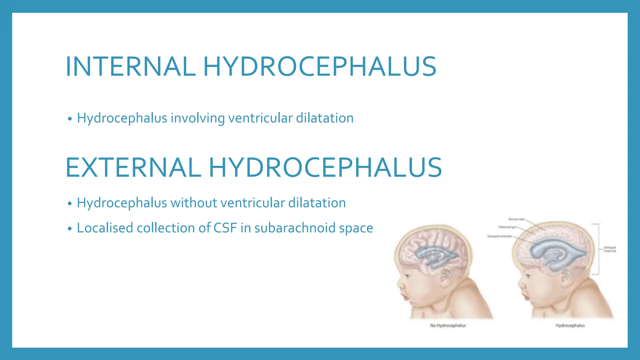 Hydrocephalus, meningitis and encephalitis - Pathology | PPTX