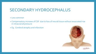 Hydrocephalus, meningitis and encephalitis - Pathology | PPTX
