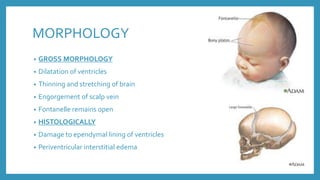 Hydrocephalus, meningitis and encephalitis - Pathology | PPTX