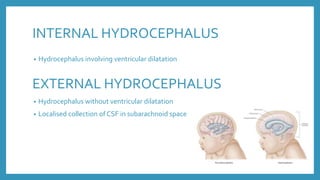 Hydrocephalus, meningitis and encephalitis - Pathology | PPTX