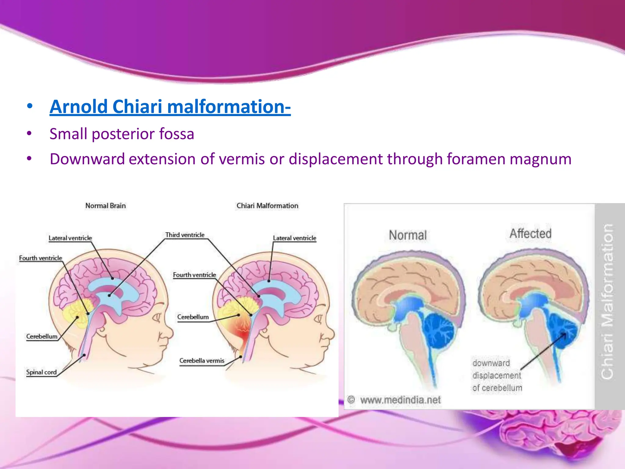 Central nervous Pathology by dr sadaf hussain | PPTX
