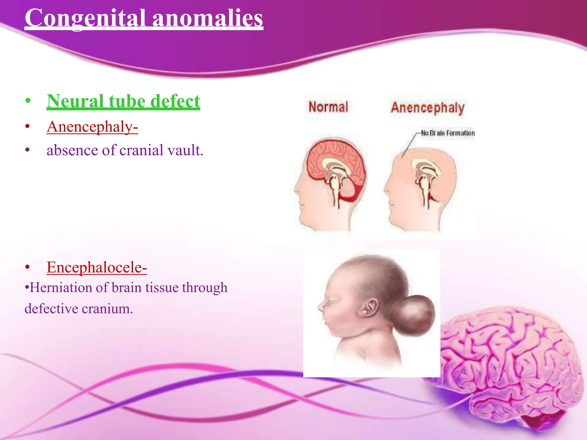 Central nervous Pathology by dr sadaf hussain | PPTX