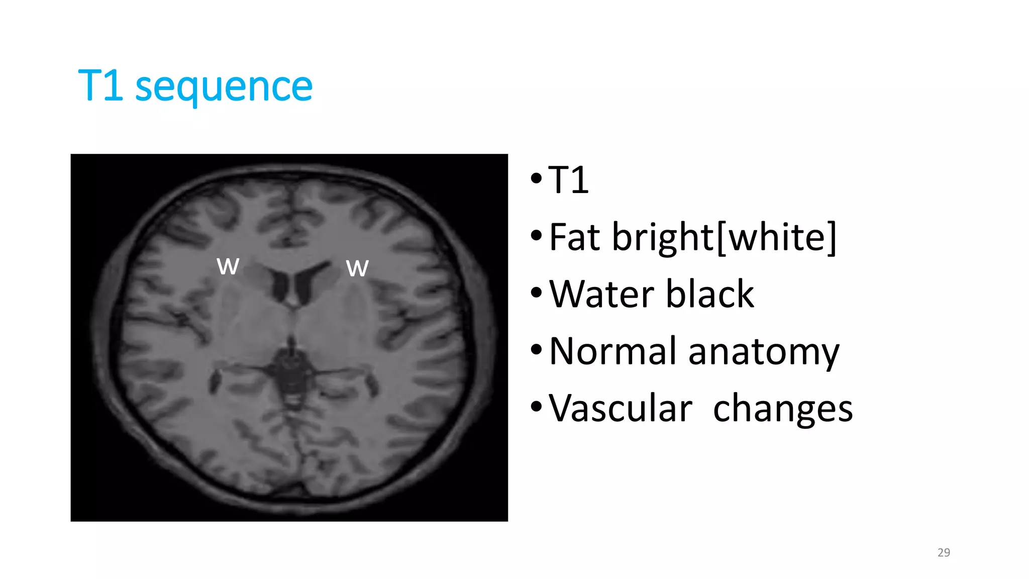 CNS RADIOLOGY FOR RADIATION ONCOLOGISTS | PPTX