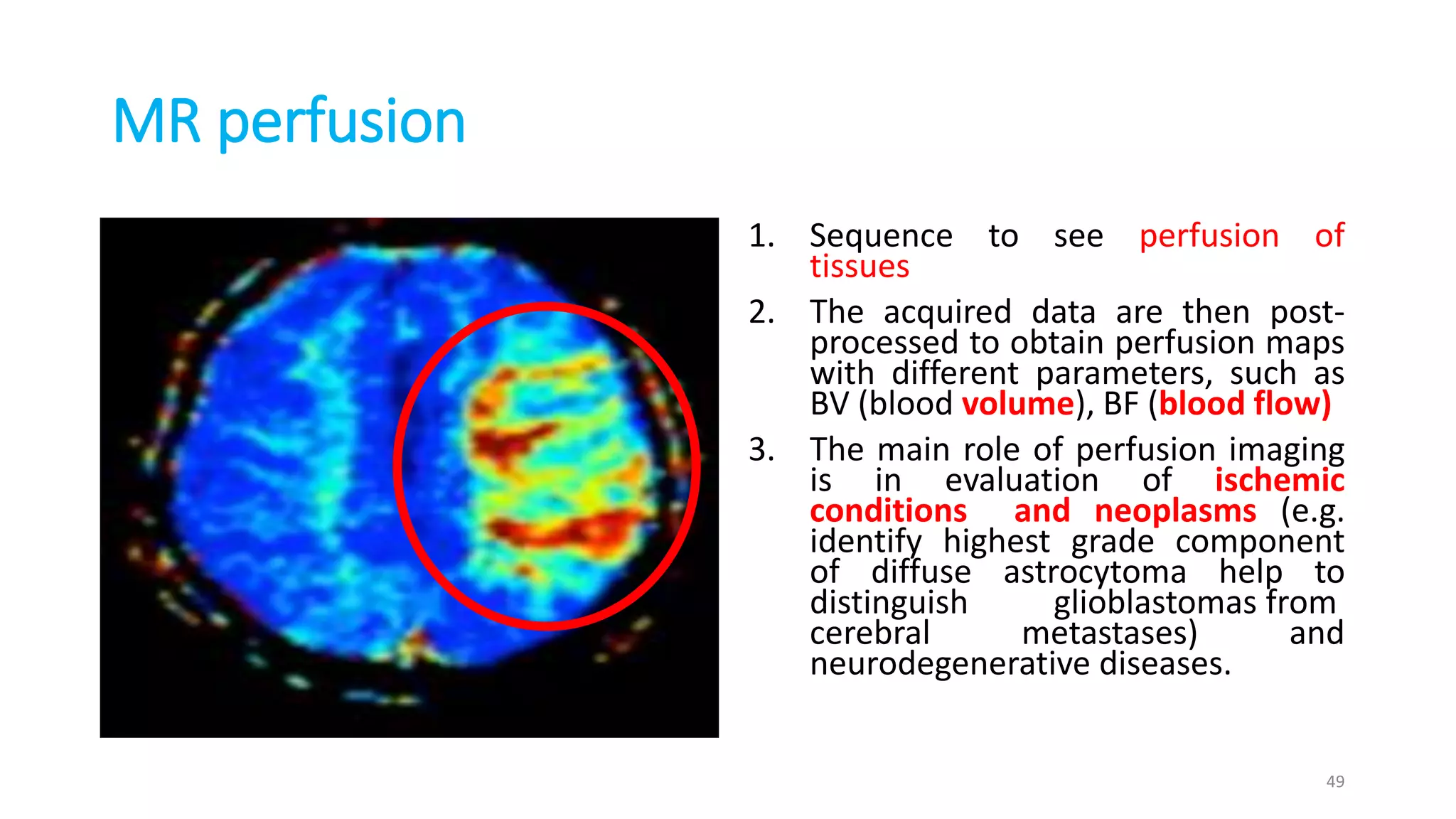CNS RADIOLOGY FOR RADIATION ONCOLOGISTS | PPTX