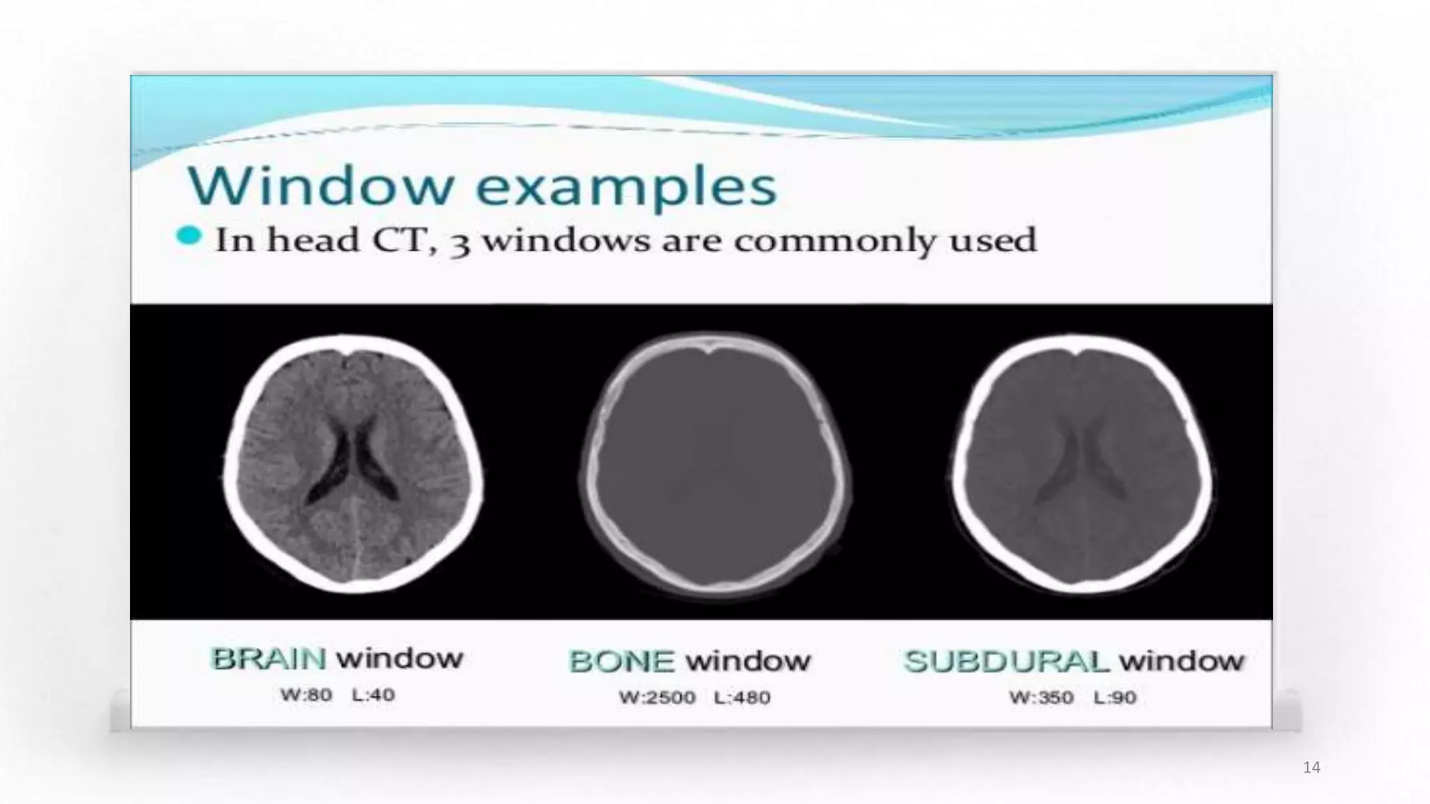 RADIOLOGY FOR CRANIAL STEREOTAXY | PPT