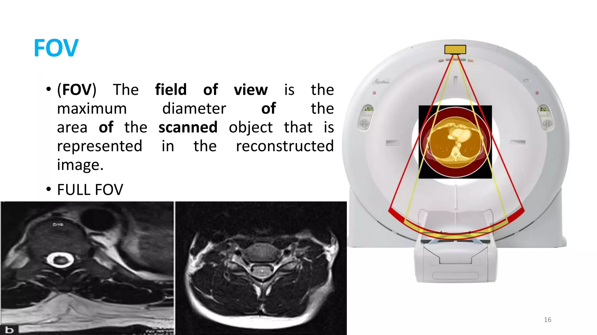 RADIOLOGY FOR CRANIAL STEREOTAXY | PPT