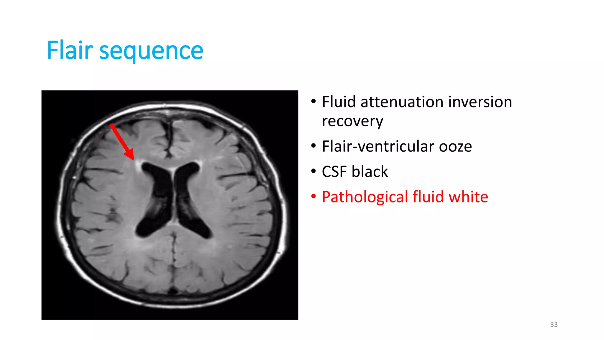 RADIOLOGY FOR CRANIAL STEREOTAXY | PPT