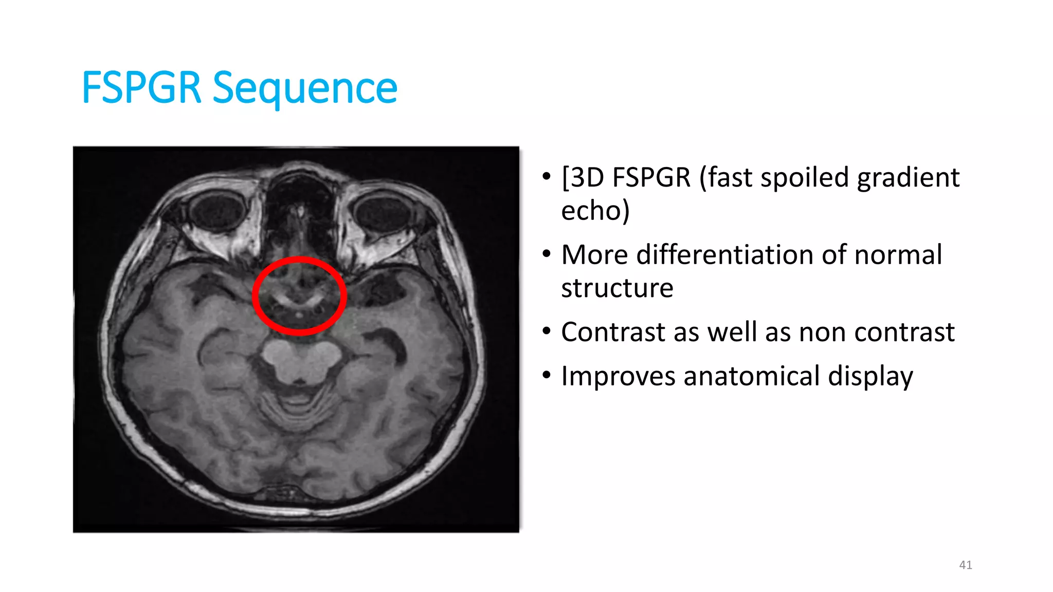 RADIOLOGY FOR CRANIAL STEREOTAXY | PPT