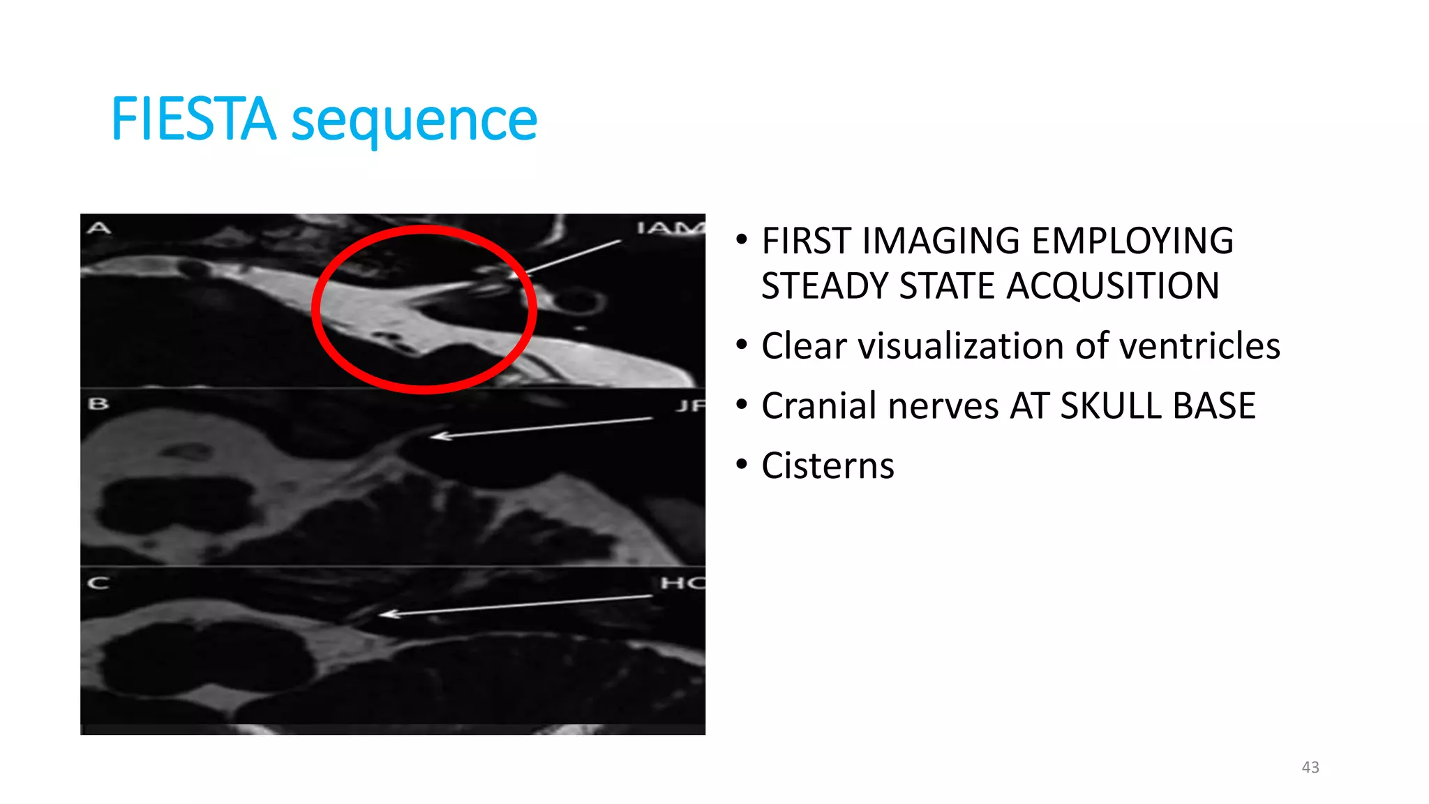 RADIOLOGY FOR CRANIAL STEREOTAXY | PPT