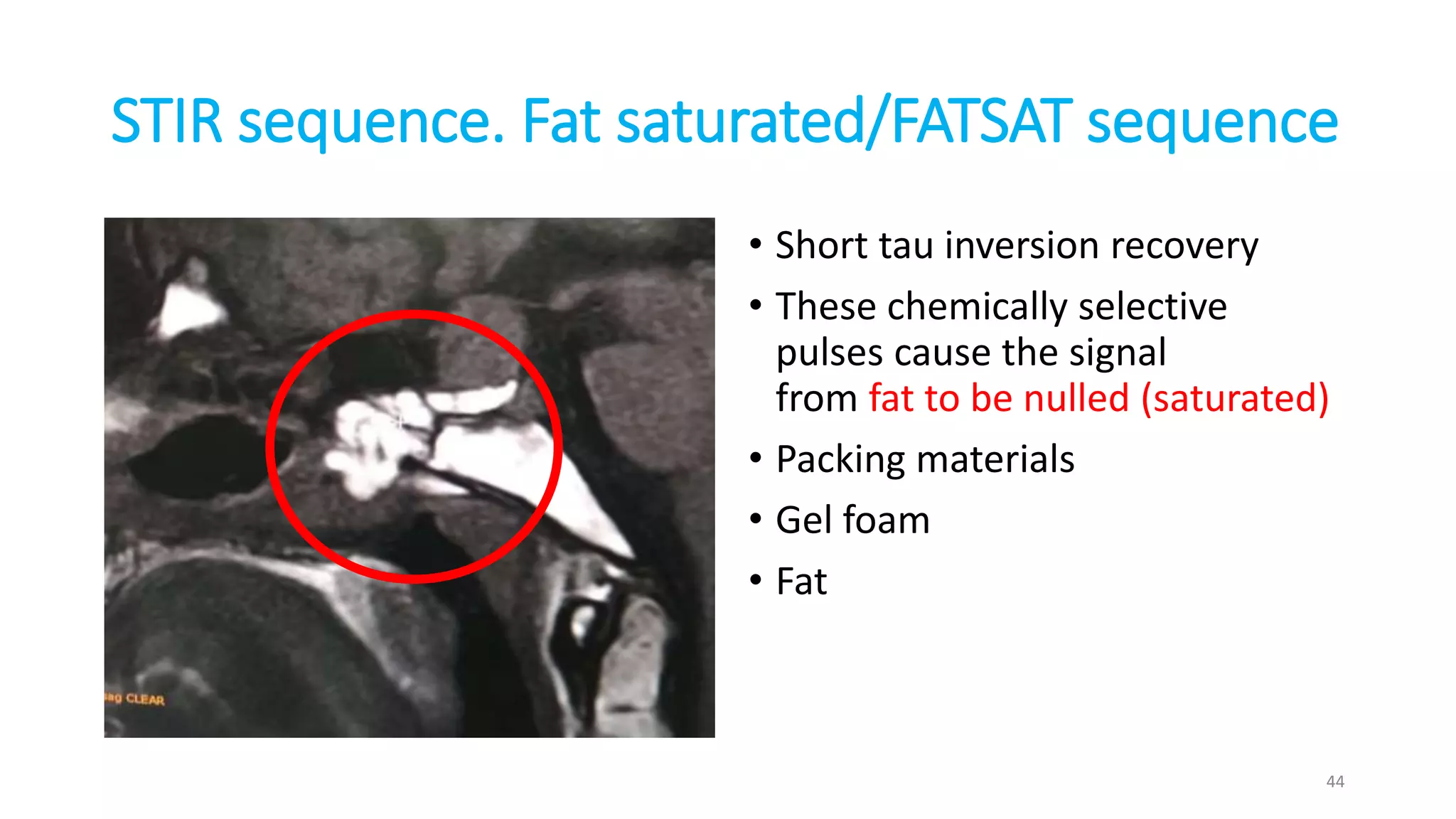 RADIOLOGY FOR CRANIAL STEREOTAXY | PPT