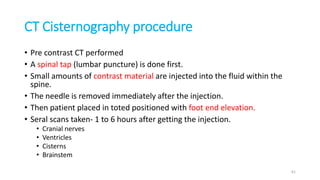 RADIOLOGY FOR CRANIAL STEREOTAXY | PPTX